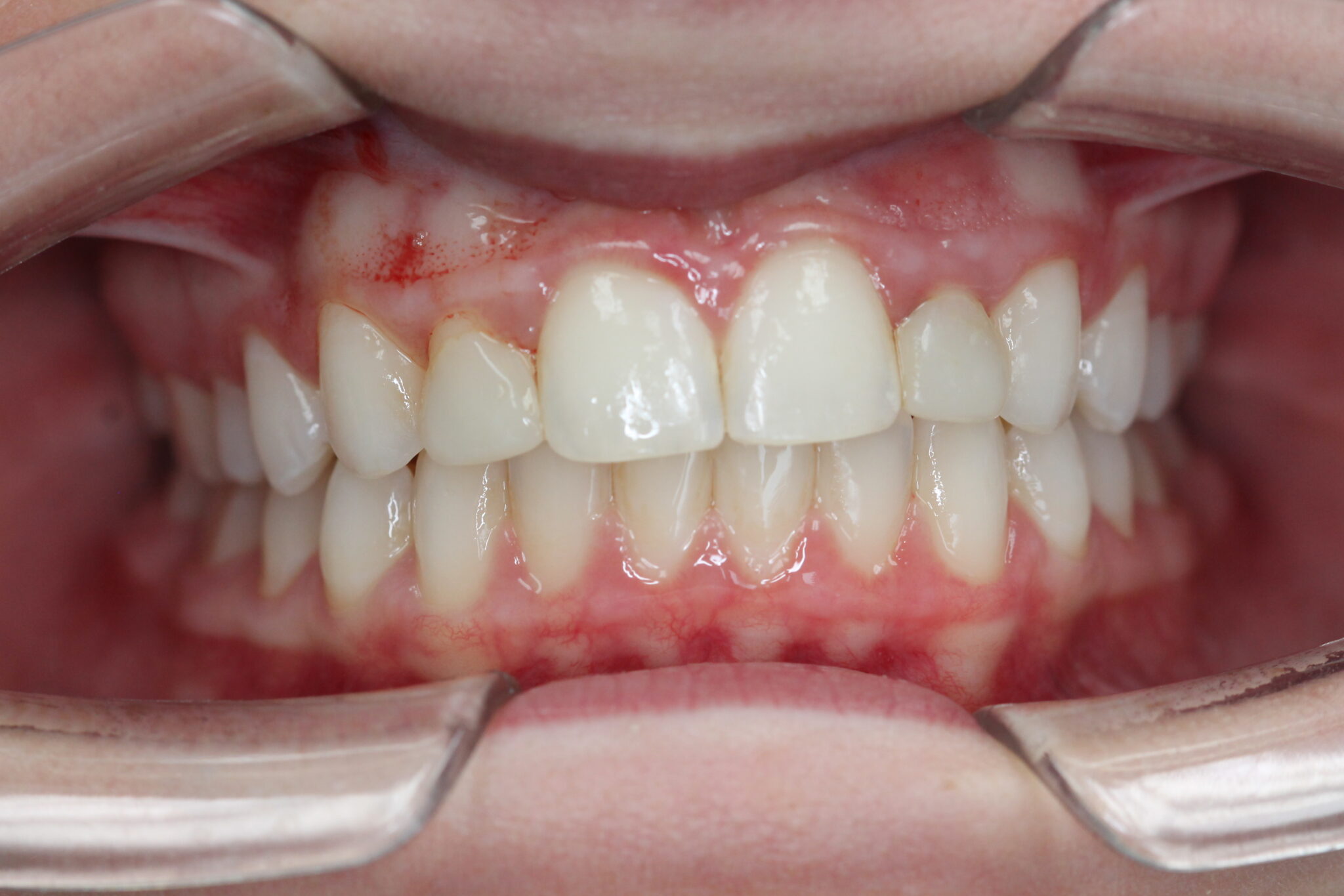 Gallery - Elegant Edge Dentistry