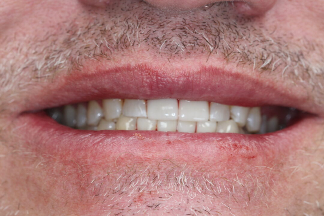 Gallery - Elegant Edge Dentistry