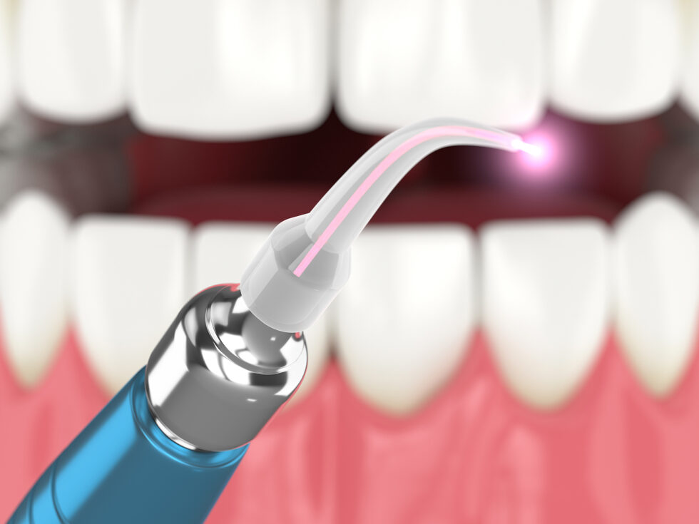 Can Shaving Your Teeth Down Fix a Big-Toothed Smile?
